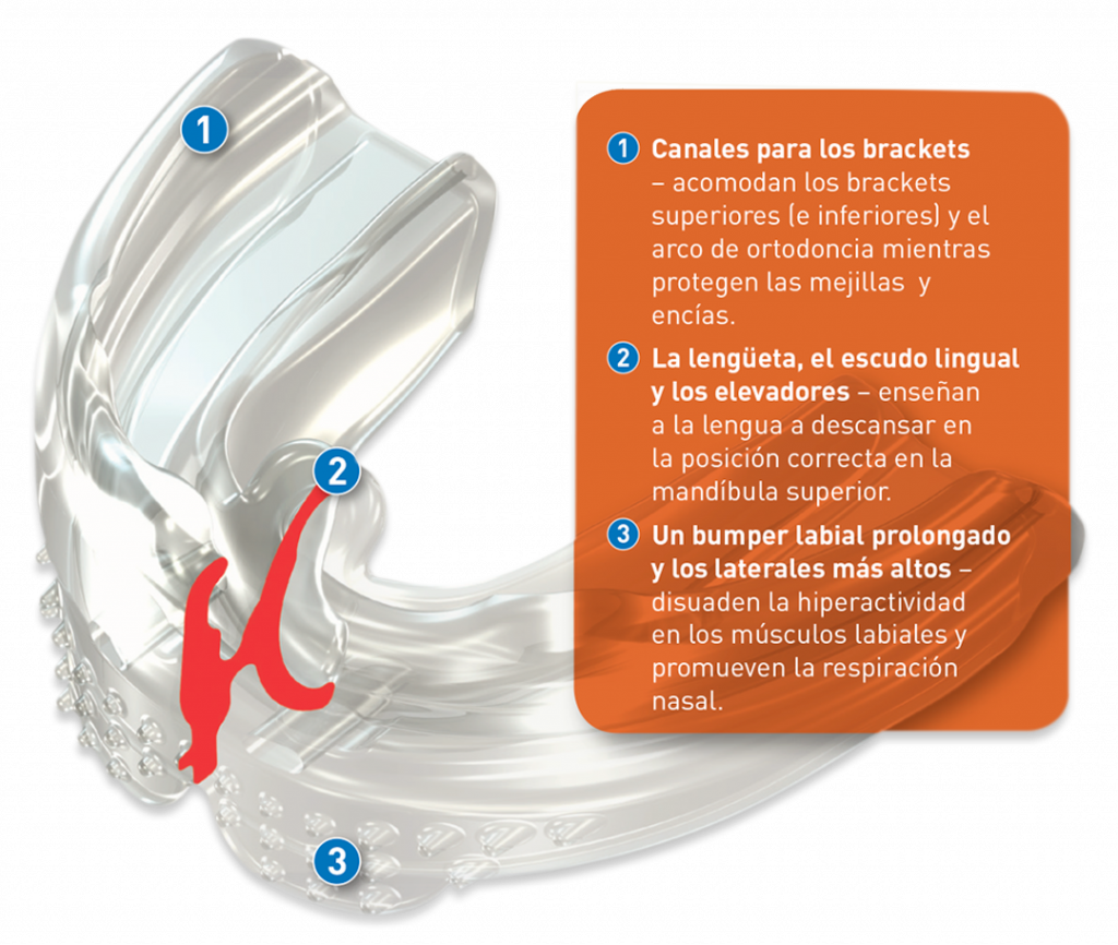 Myobrace para Brackets - Pacific Orthodontics